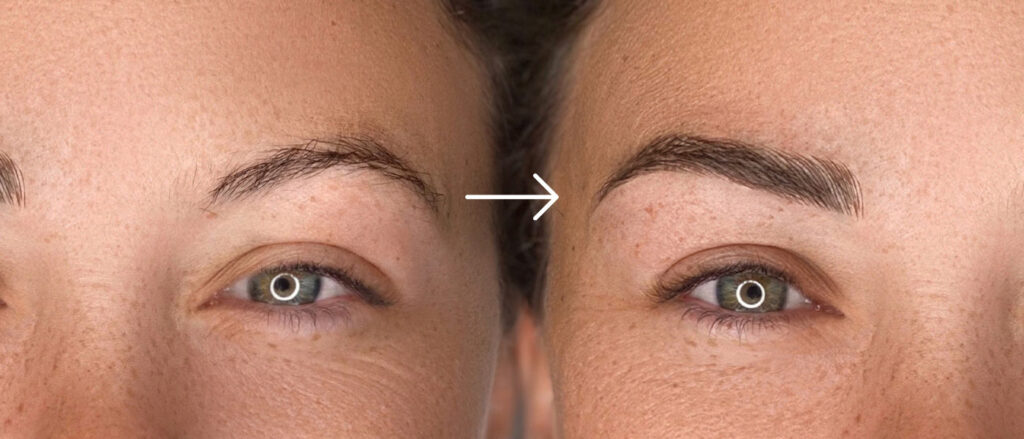 Eyebrow Makeover: Microblading & Ombré Brows